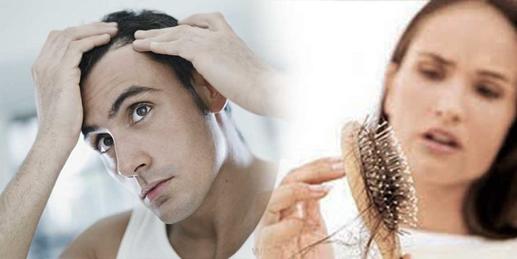 It’s National Hair Loss Awareness Month. | Innovate Salon Academy